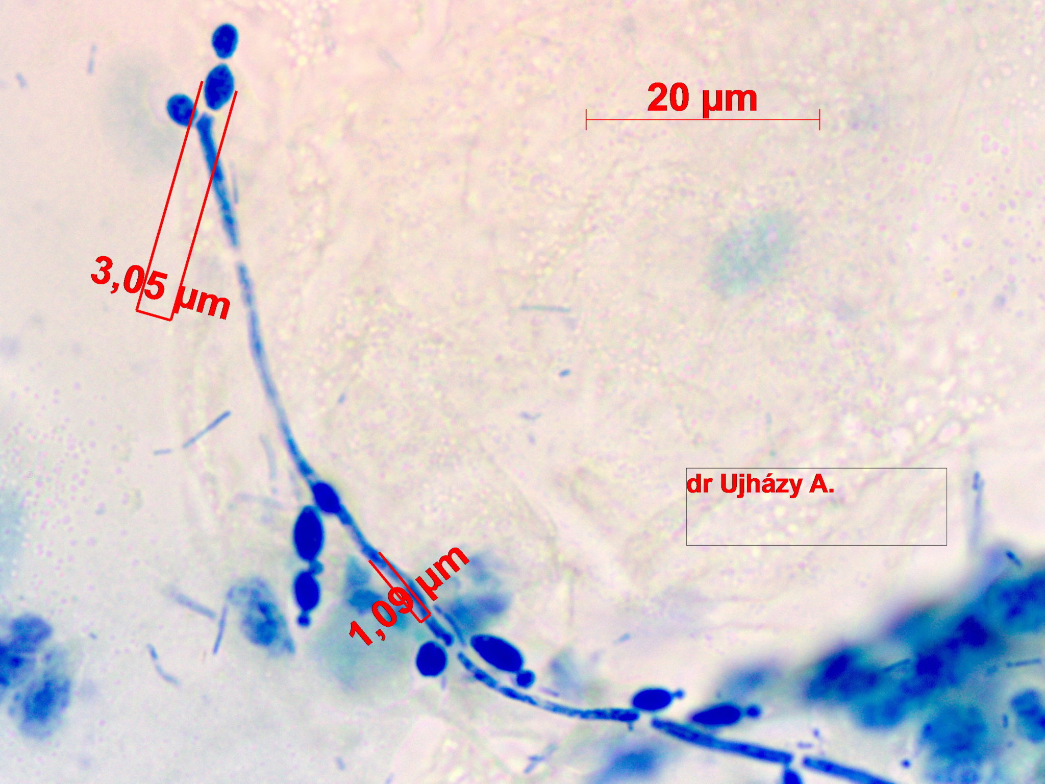Nőgyógyászati infektológiai rendelés – Szent Magdolna Magánkórház